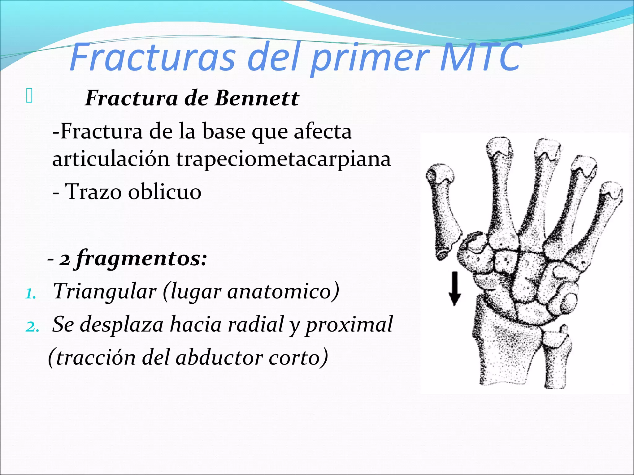 Fracturas de falanges completa 2 | PPT | First Aid | Injuries