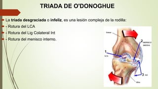 Fracturas de femur distal y lesiones de rodilla | PPTX