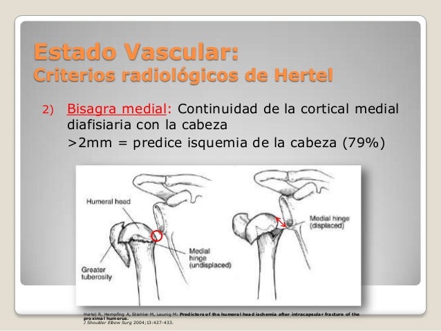 Fracturas de húmero manejo conservador