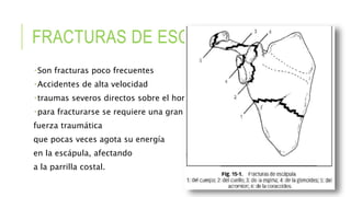 Fracturas de hombro | PPTX