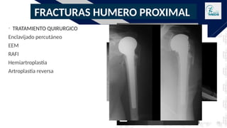 Fracturas de Humero proximal distal y diafisiario | PPTX