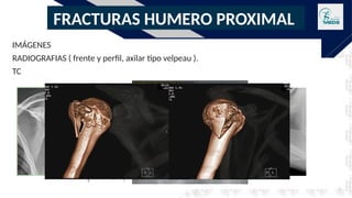 Fracturas de Humero proximal distal y diafisiario | PPTX