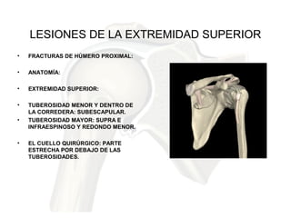 Fracturas de humero proximal (2) | PPT