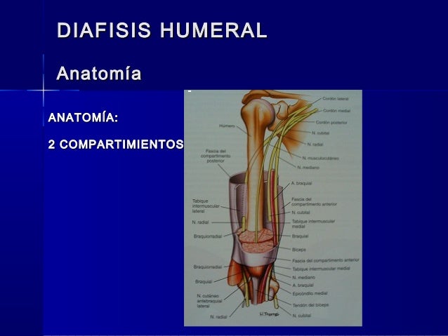 Fracturas de la diafisis humeral