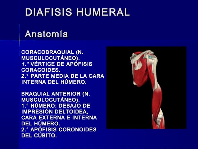 Fracturas de la diafisis humeral