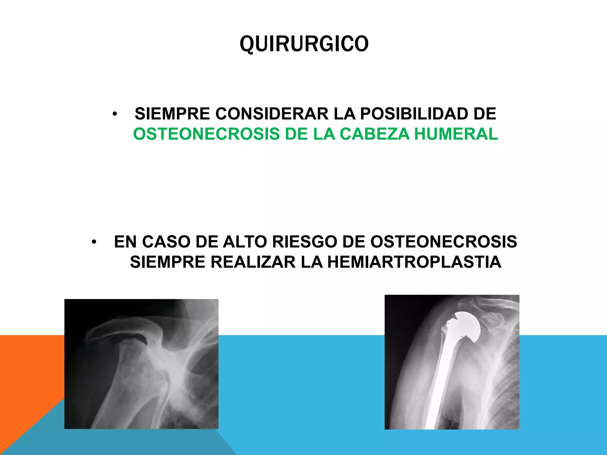 Fracturas de la extremidad proximal del humero | PPTX