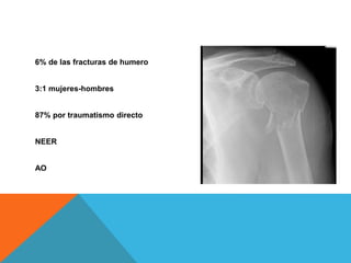 Fracturas de la extremidad proximal del humero | PPTX
