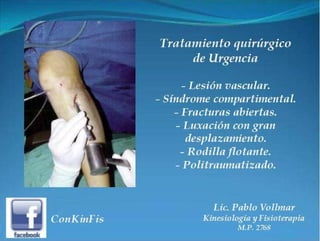 fracturas de la meseta o platillo tibial.PDF