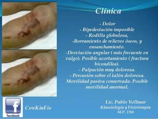 fracturas de la meseta o platillo tibial.PDF