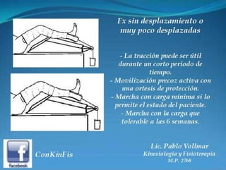 fracturas de la meseta o platillo tibial.PDF