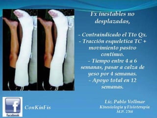 fracturas de la meseta o platillo tibial.PDF