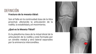 Fracturas De La Meseta Tibial C Pptx