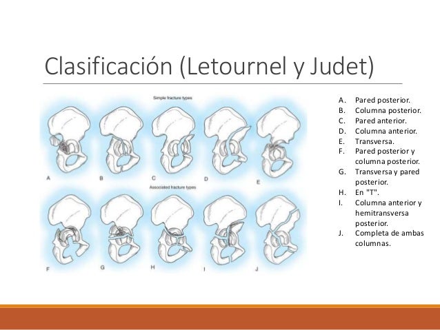 Fracturas de la pelvis