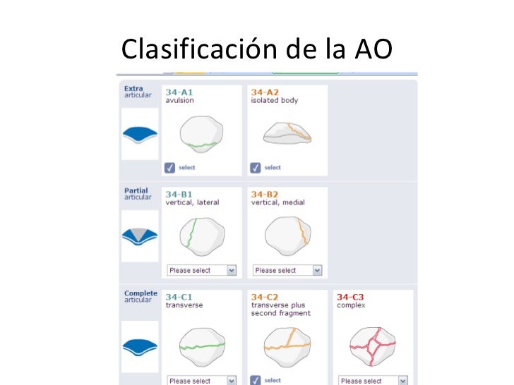 Fracturas de la rodilla