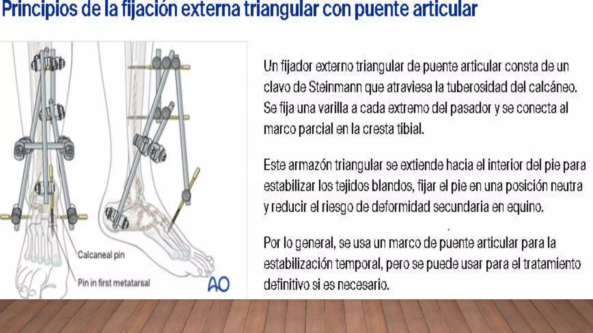 FRACTURAS DEL PILON TIBIAL.pptx