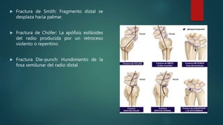 Fracturas del radio distal total.pptx