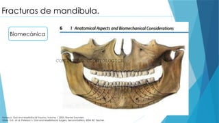 Fracturas de mandíbula- manejo tto .pptx