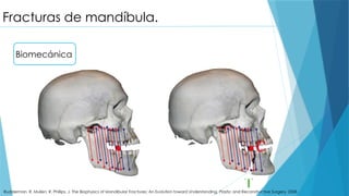 Fracturas de mandíbula- manejo tto .pptx