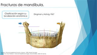Fracturas de mandíbula- manejo tto .pptx