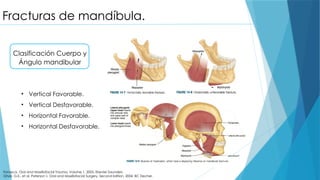 Fracturas de mandíbula- manejo tto .pptx