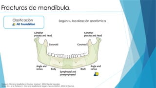Fracturas de mandíbula- manejo tto .pptx