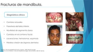 Fracturas de mandíbula- manejo tto .pptx