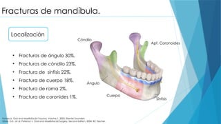 Fracturas de mandíbula- manejo tto .pptx