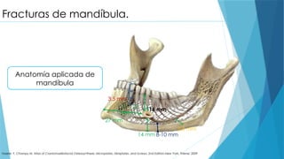 Fracturas de mandíbula- manejo tto .pptx