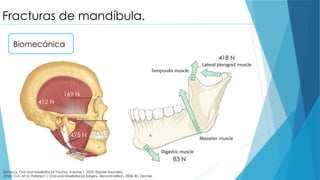 Fracturas de mandíbula- manejo tto .pptx