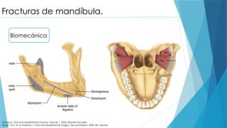 Fracturas de mandíbula- manejo tto .pptx