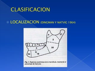 Clasificación De Fractura De Mandíbula
