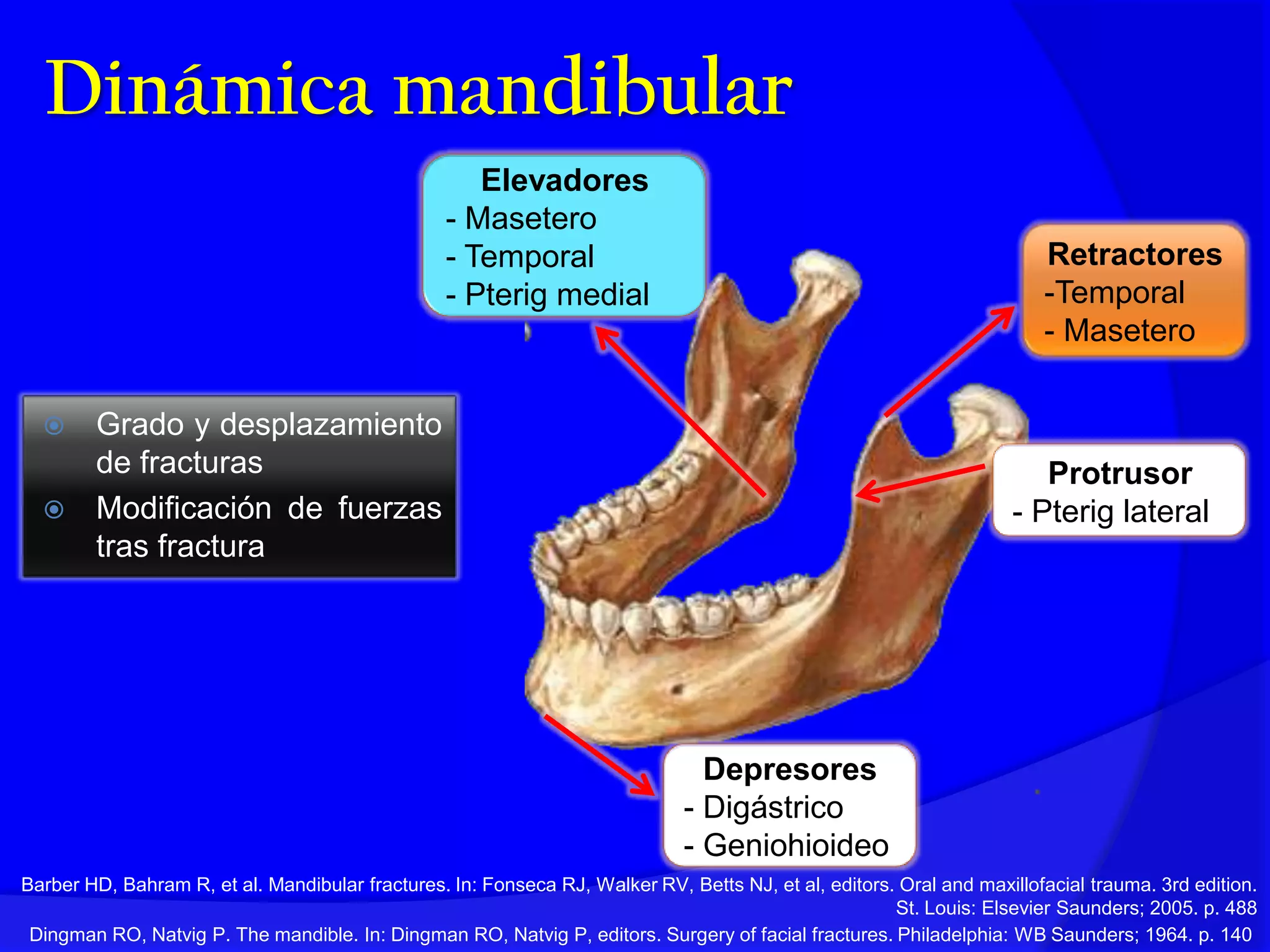 Fracturas de mandibula archivo definitivo | PPTX