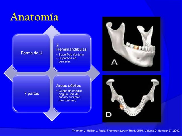Fracturas de mandibula archivo definitivo | PPTX
