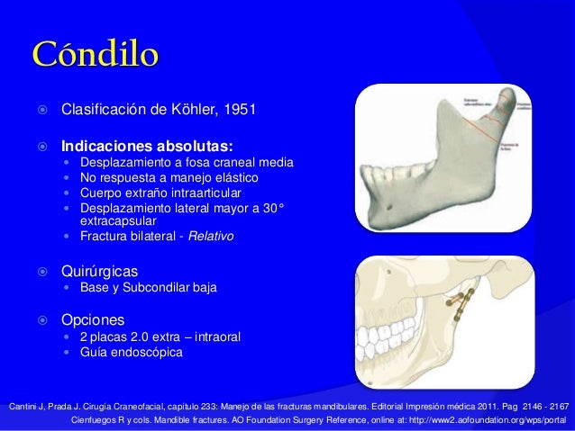Fracturas de mandibula archivo definitivo