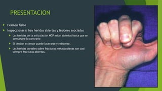 FRACTURAS DE METACARPO CLASIFICACION TRATAMIENTO | PPTX