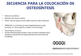 Fracturas de Orbita y principios osteosintesis .pptx