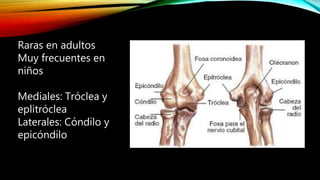 Fracturas de paleta humeral | PPTX