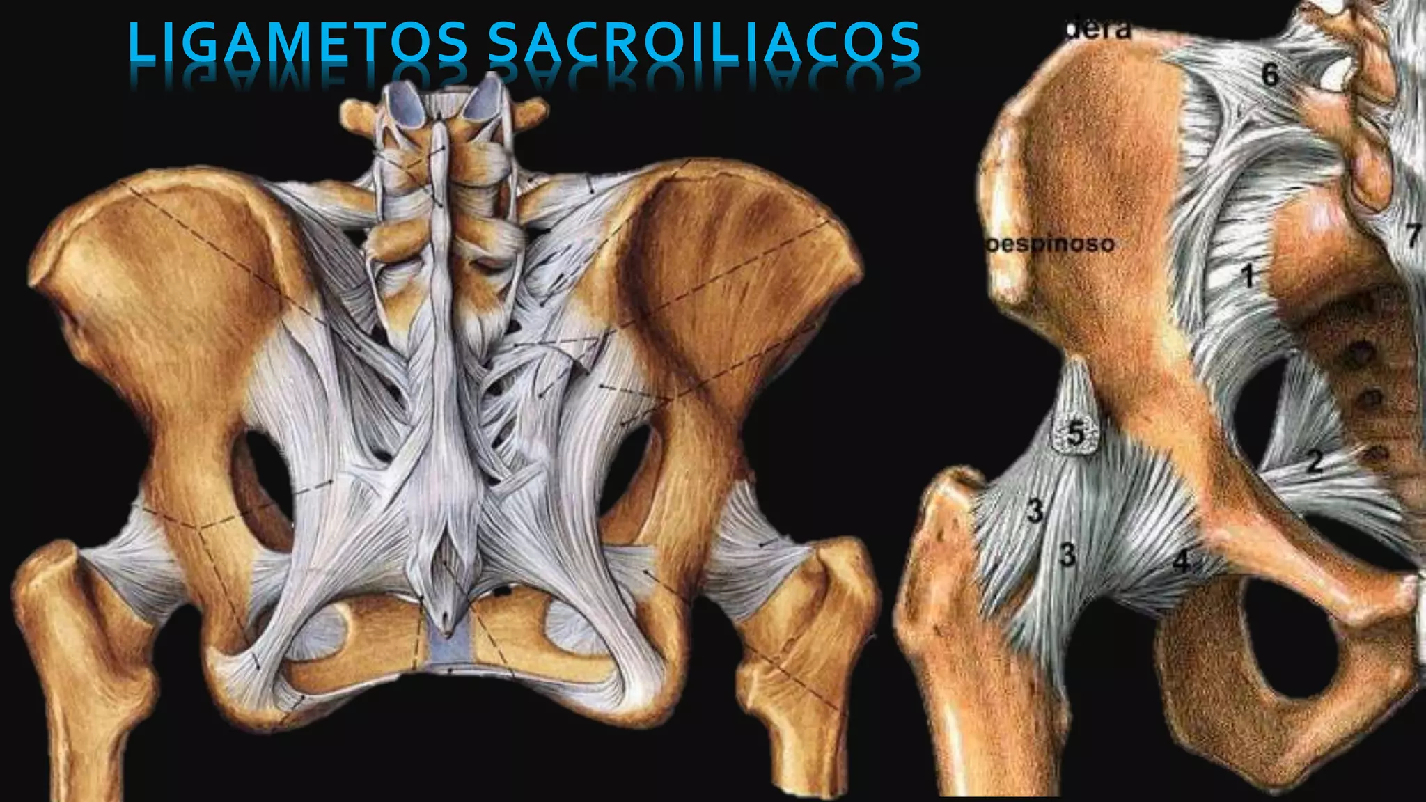 FRACTURAS DE PELVIS Y ACETABULO. TRAUMATOLOGÍA | PPT