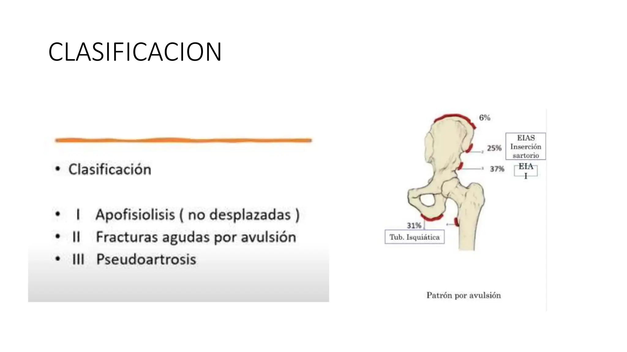 FRACTURAS DE PELVIS EN NIÑOS TRAUMATOLOGIA | PPTX