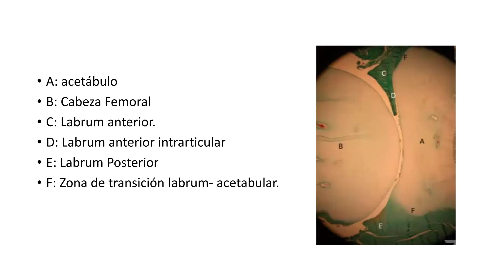 FRACTURAS DE PELVIS EN NIÑOS TRAUMATOLOGIA | PPTX
