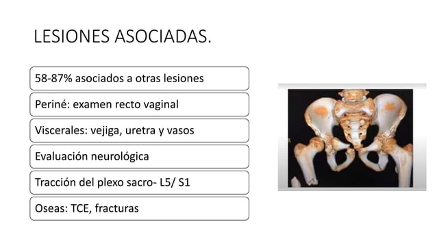 FRACTURAS DE PELVIS EN NIÑOS TRAUMATOLOGIA | PPTX