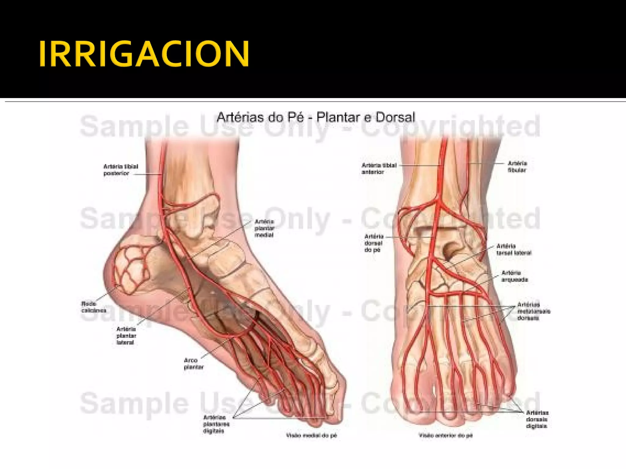 Fracturas de pilon tibial | PPT