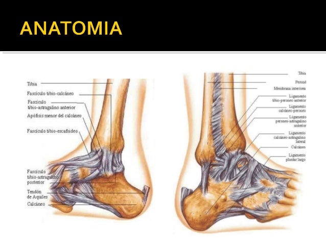 Fracturas de pilon tibial