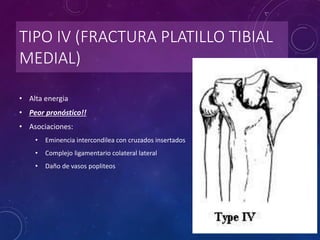 FRACTURAS DE PLATILLOS TIBIALES.pptx