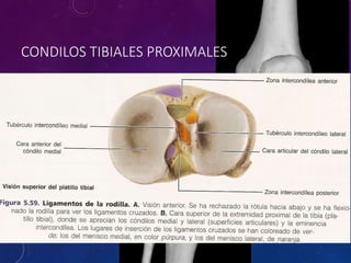 FRACTURAS DE PLATILLOS TIBIALES.pptx