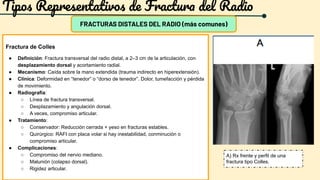 FRACTURAS DE radios distales diafisiarias y proximales | PDF