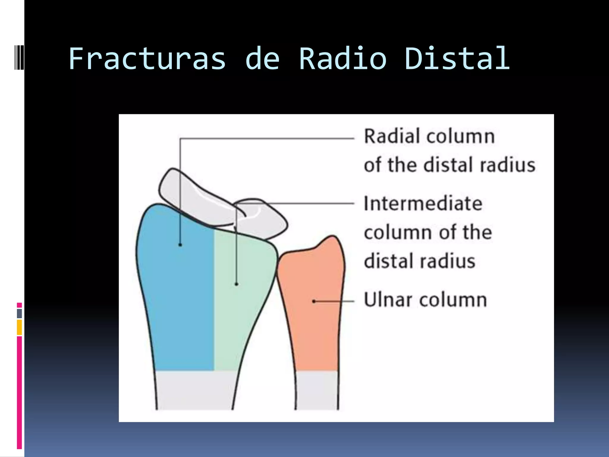 Fracturas de radio distal - Generalidades | PPTX | Death, Injury, or ...
