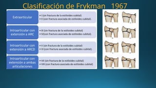 FRACTURAS DE hueso RADIO DISTAL, antbrazo | PPT