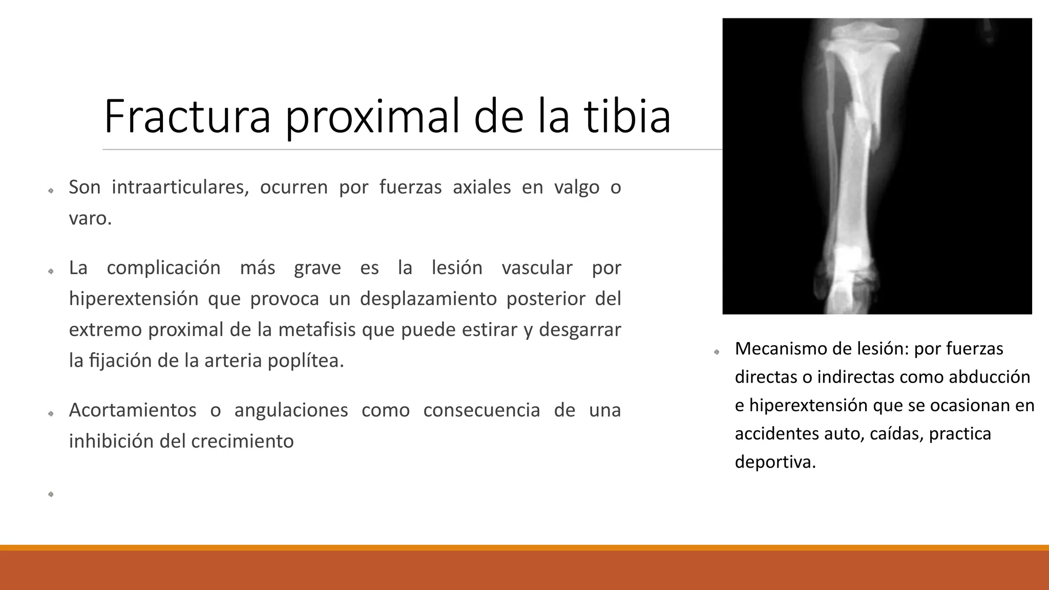 Fracturas de tibia y perone | PPTX