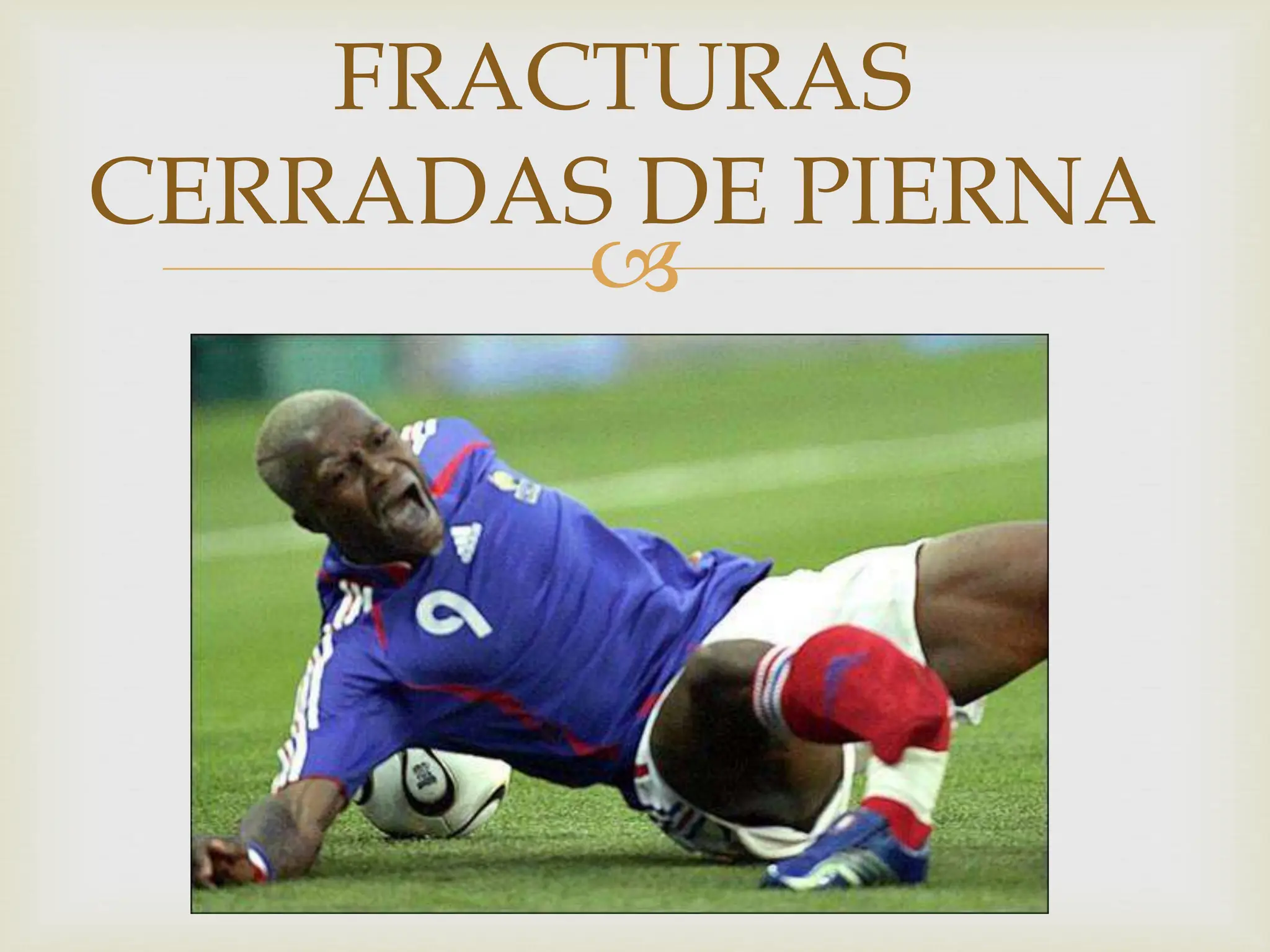 FRACTURAS DE TIBIA Y PERONE DROV.ppt x | PPTX